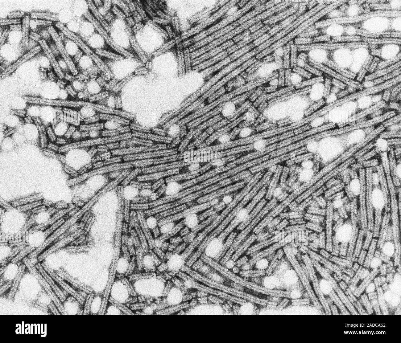 Tobacco mosaic virus (TMV, RNA virus, Family Virgaviridae ...