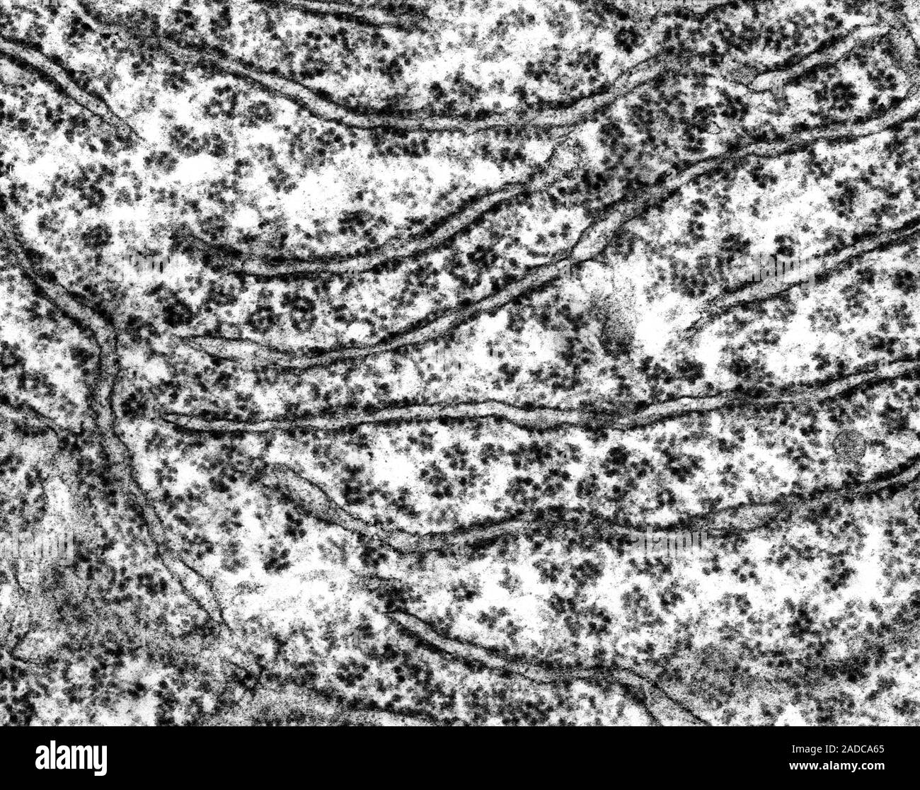 Rough endoplasmic reticulum with ribosomes on the surface (mammal ...