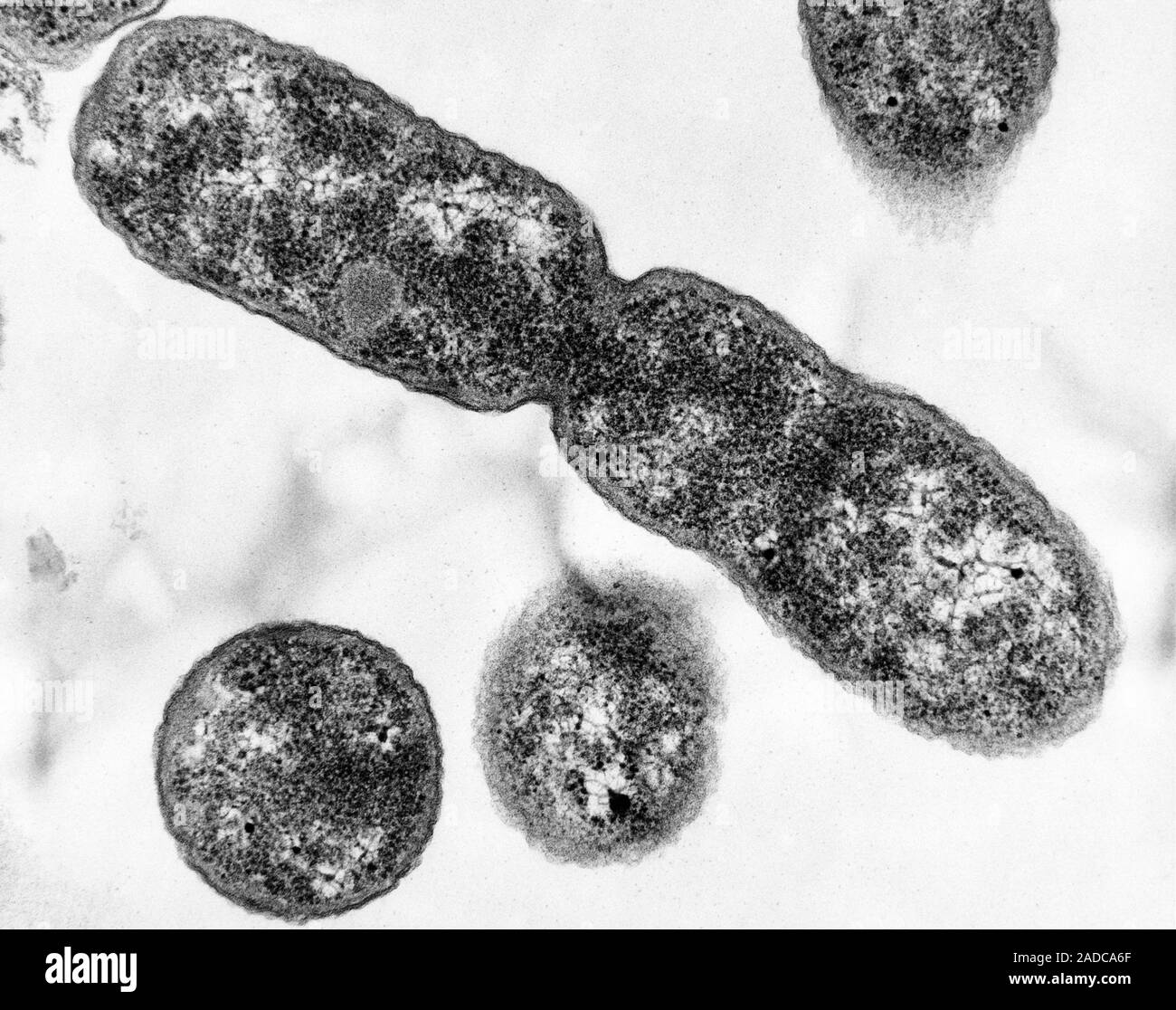 Transmission electron micrograph (TEM) of Escherichia coli is a Gram ...