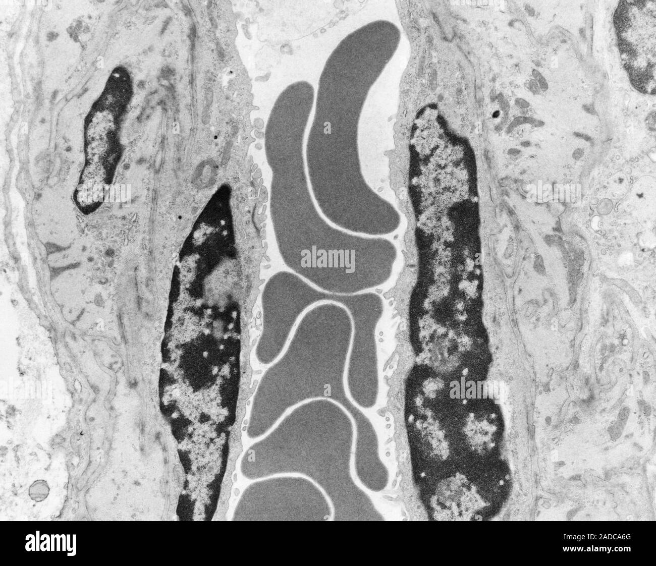 Red blood cells in a capillary (human central nervous system ...
