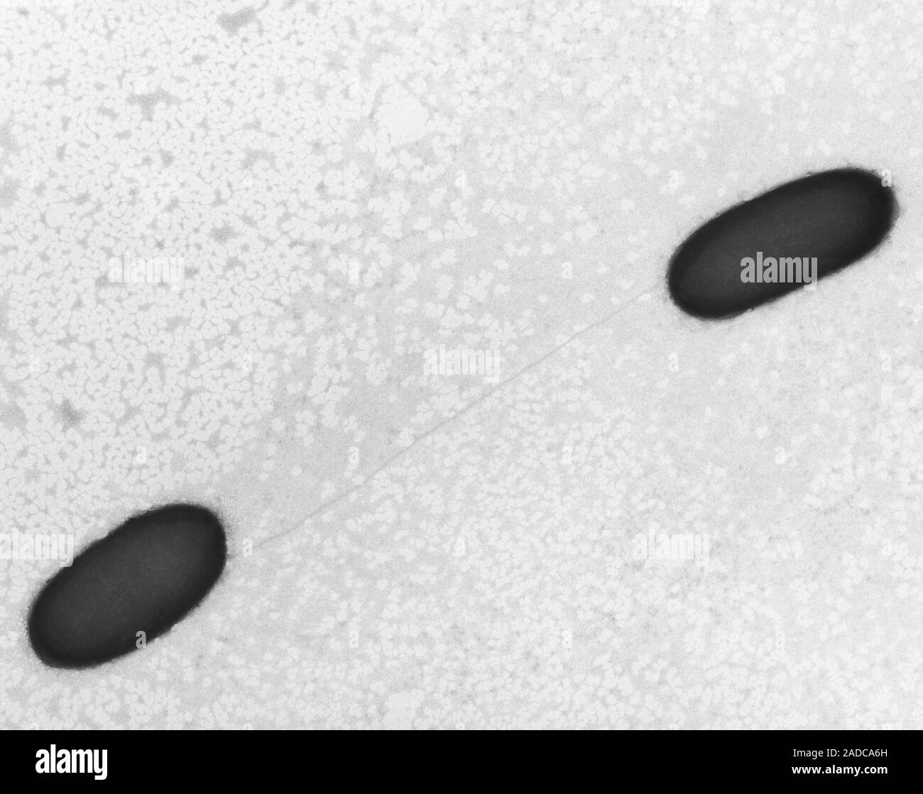 Transmission electron micrograph (TEM) of E. coli strains undergoing ...