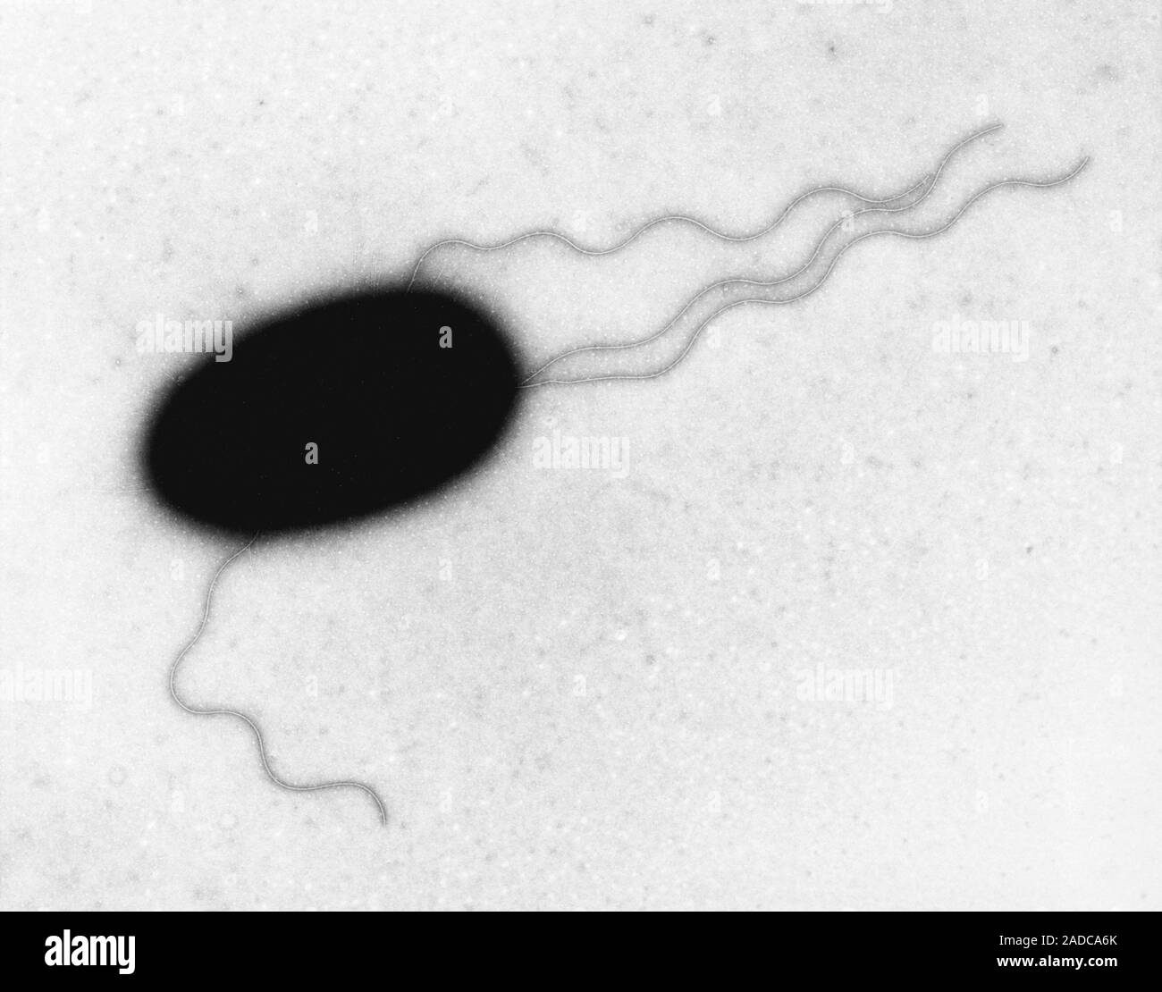 Transmission electron micrograph (TEM) of Escherichia coli is a Gram ...