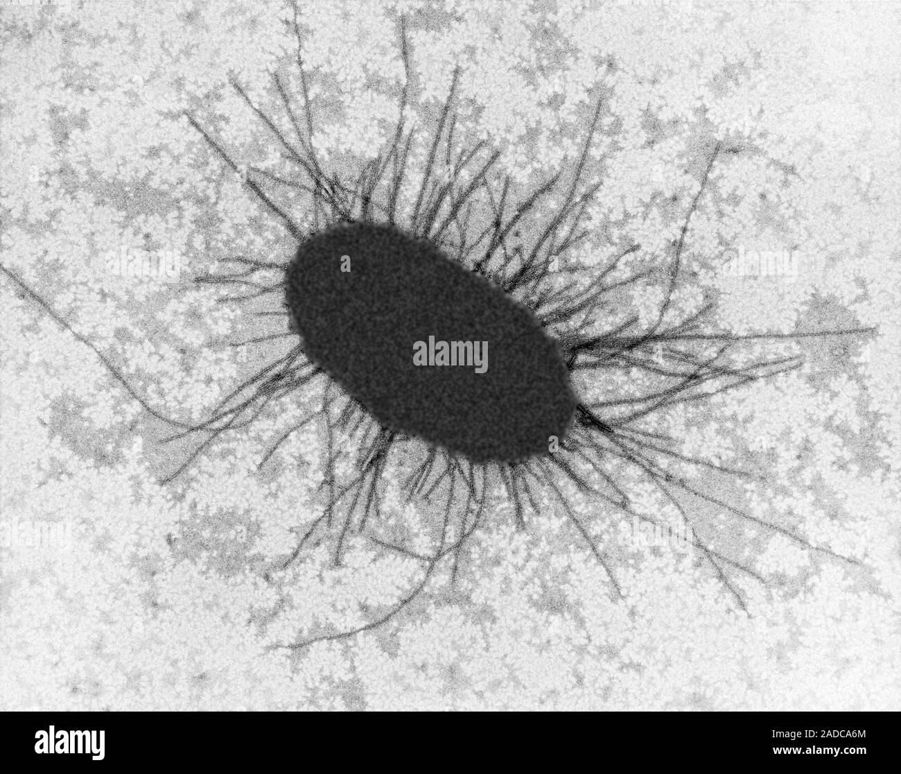 Transmission electron micrograph (TEM) of Escherichia coli is a Gram ...