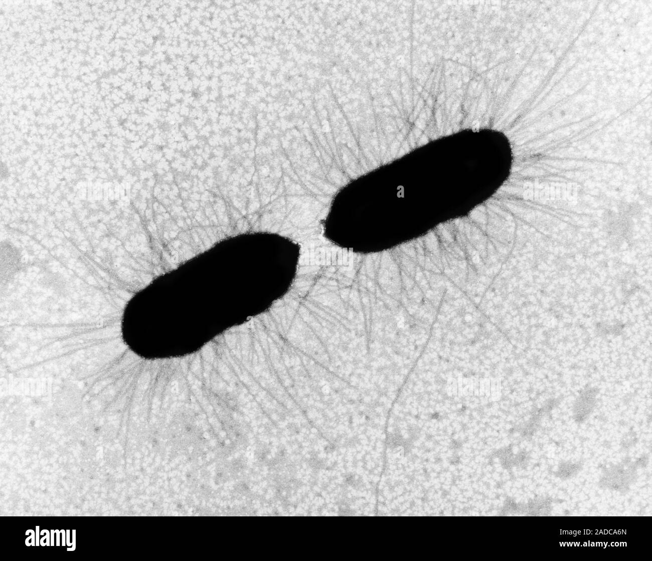 Transmission electron micrograph (TEM) of Escherichia coli is a Gram ...