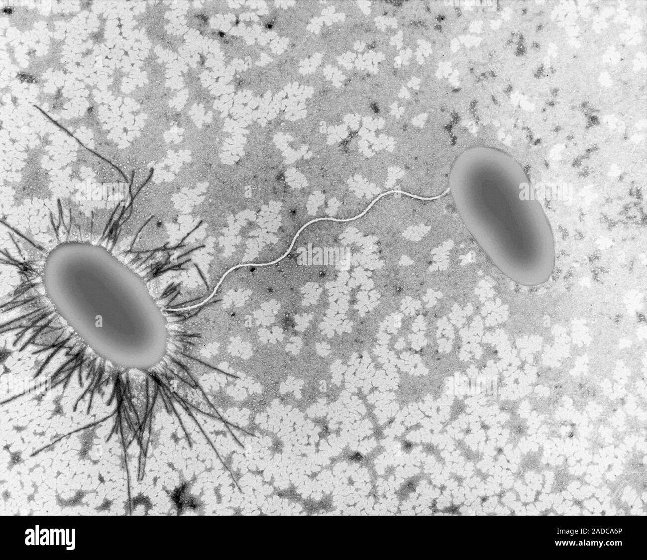 Transmission electron micrograph (TEM) of E. coli strains undergoing ...