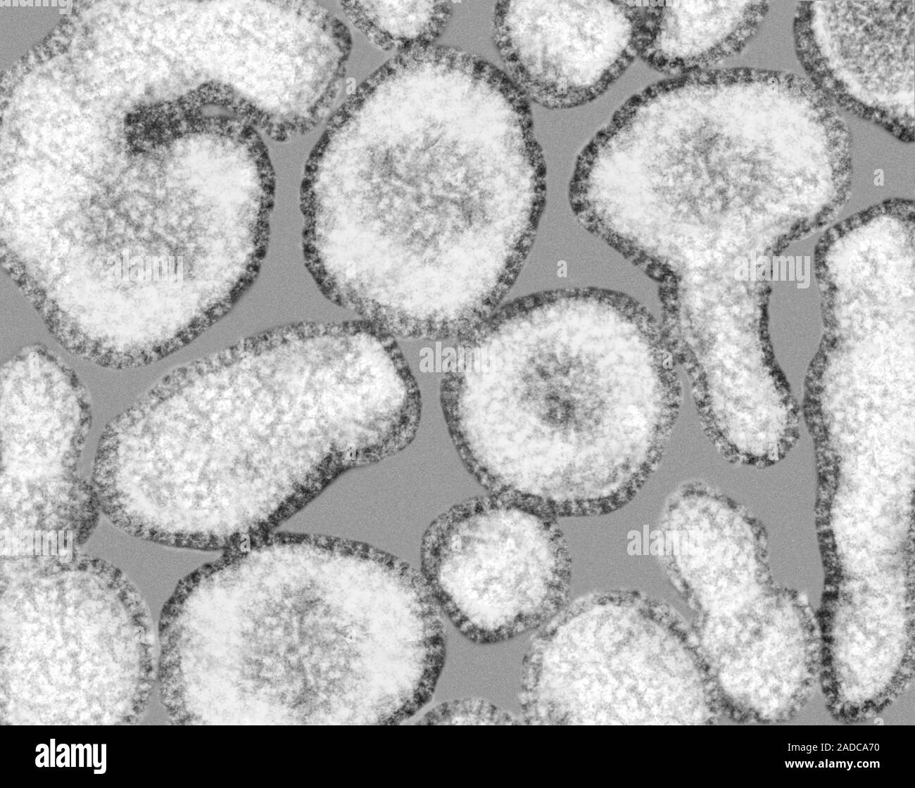 Influenza A virus (RNA virus, Orthomyxoviridae Family), transmission ...
