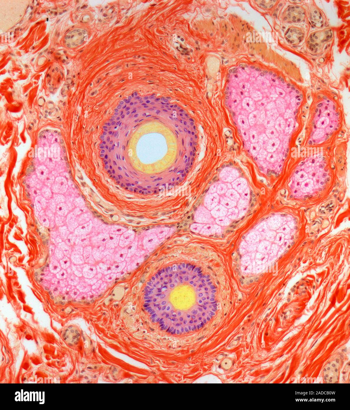 Skin. Light micrograph of a section through skin dermis showing hair ...