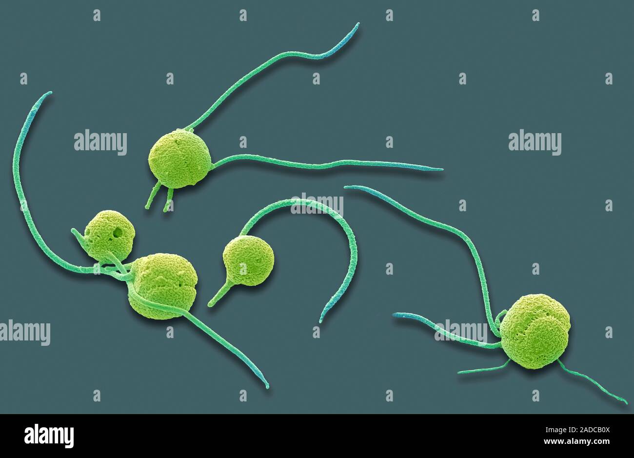 Mantoniella algae. Coloured scanning electron micrograph (SEM) of ...