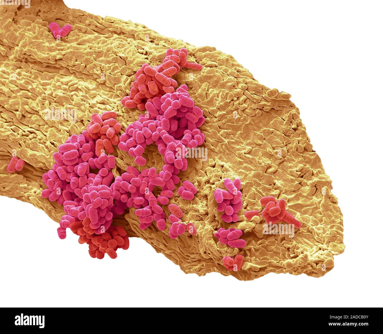 Bacterial culture from the umbilicus (belly button). Scanning electron ...
