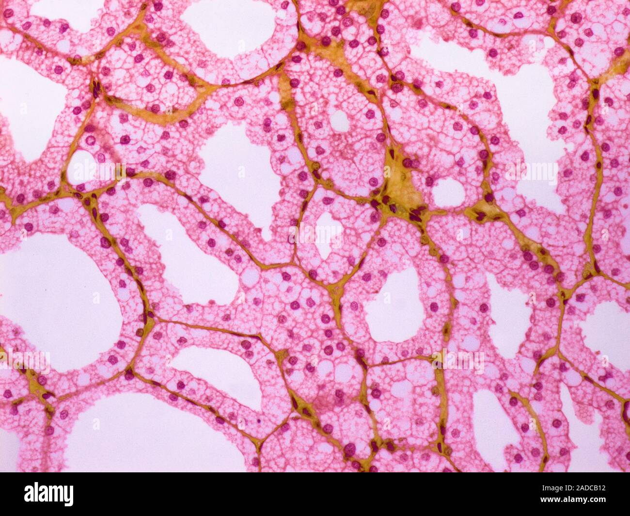 Lachrymal gland. Light micrograph of a section through the lachrymal ...