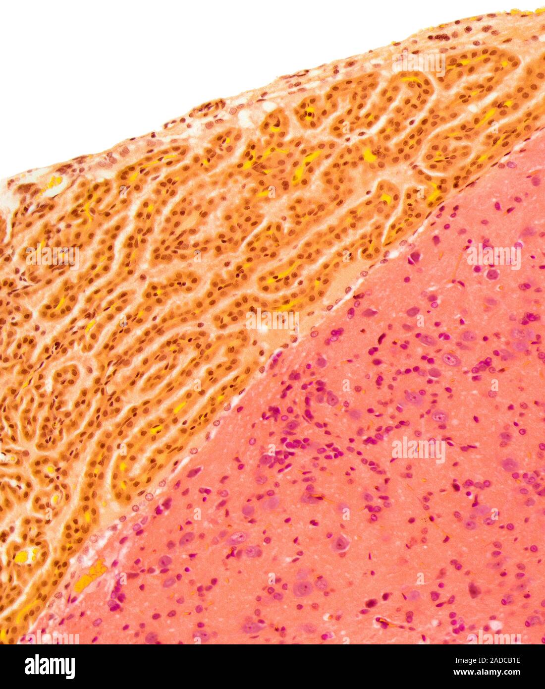 Choroid plexus. Light micrograph of a section through the choroid ...