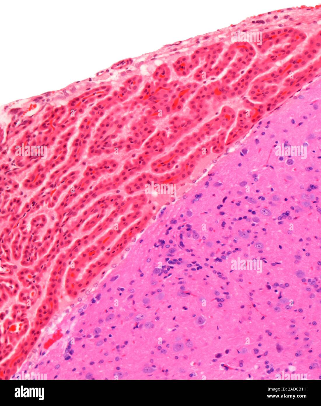 Choroid plexus. Light micrograph of a section through the choroid ...