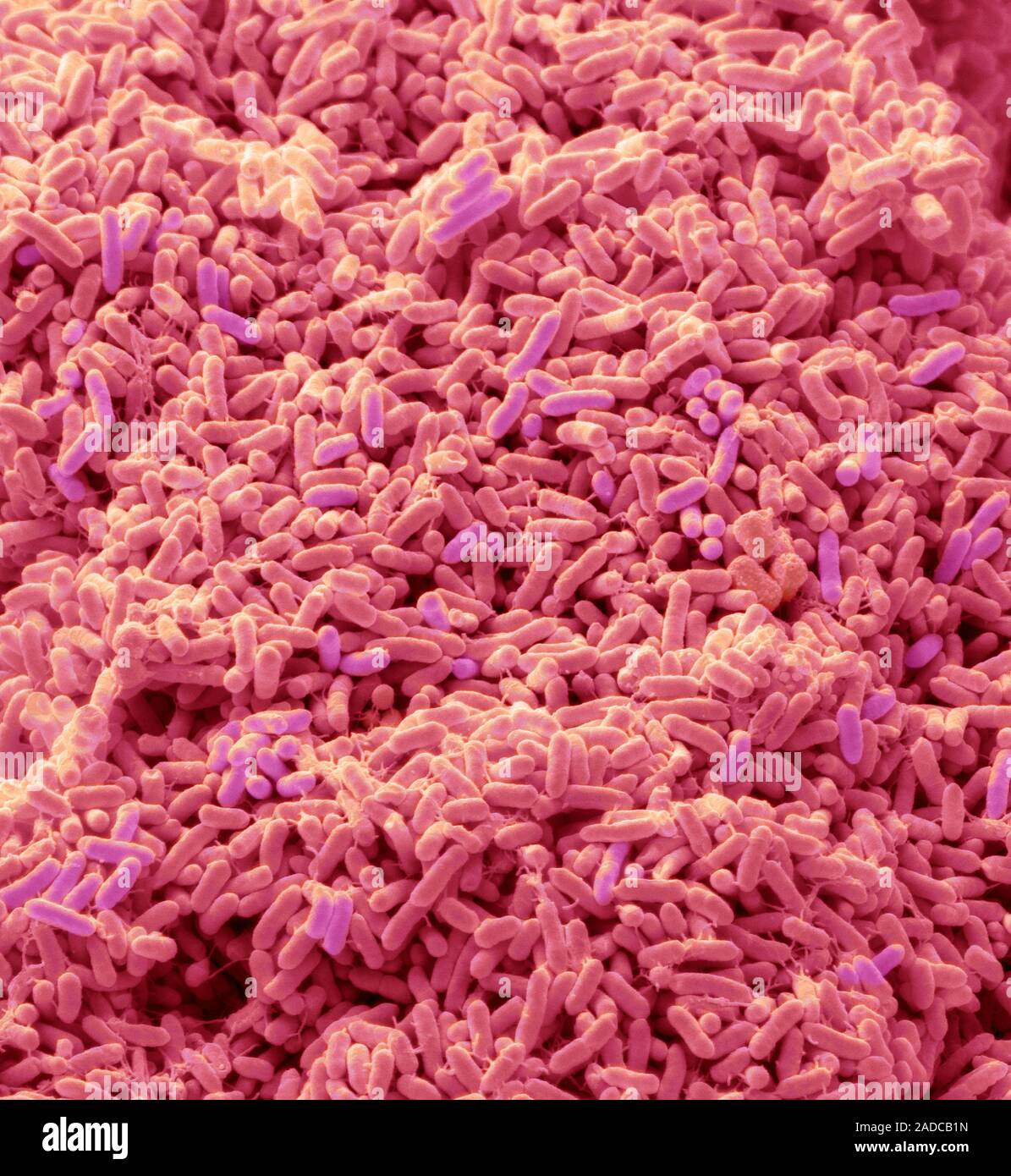 Bacterial culture from a trainer. Scanning electon micrograph (SEM) of ...