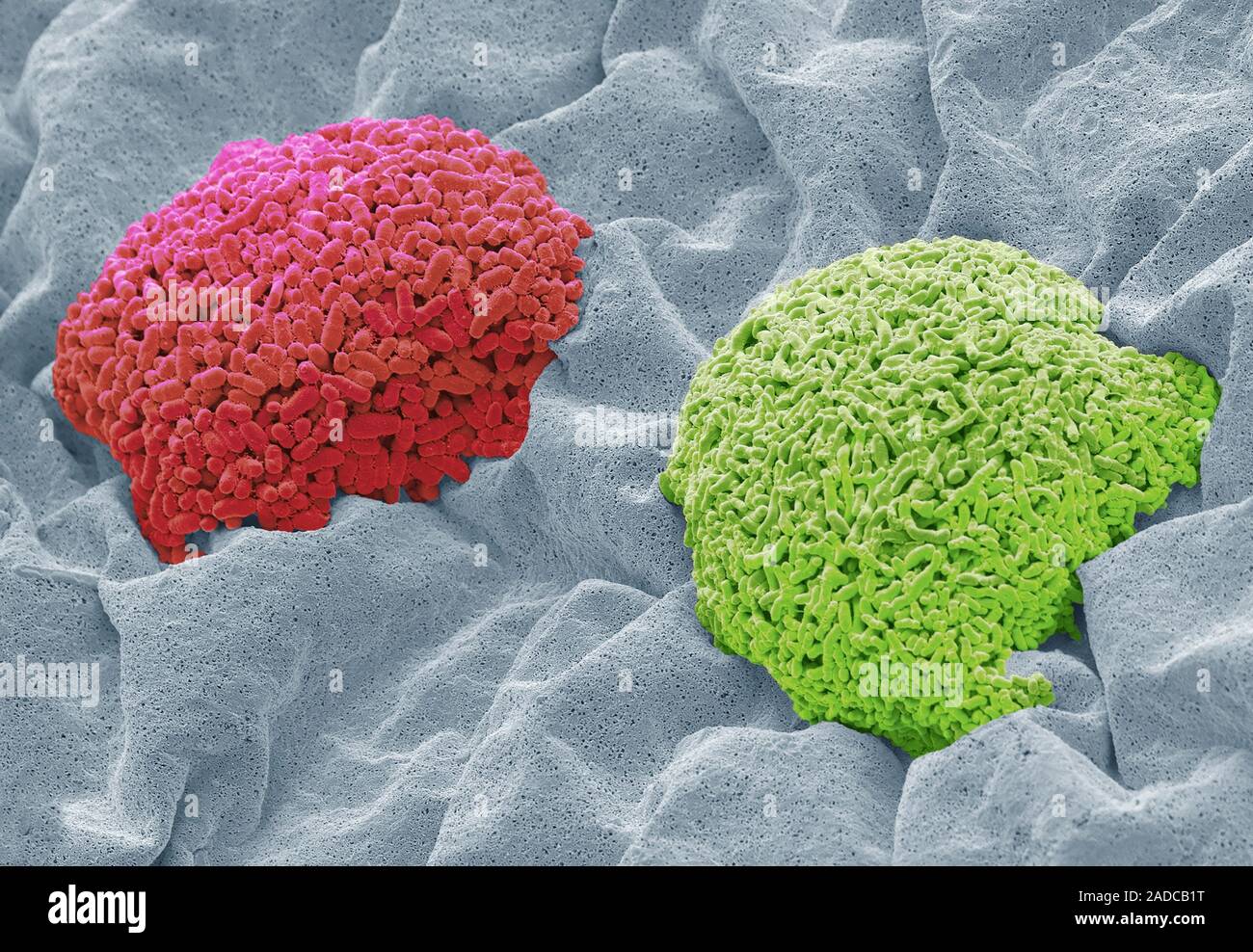 Bacterial culture from the umbilicus (belly button), scanning electron ...