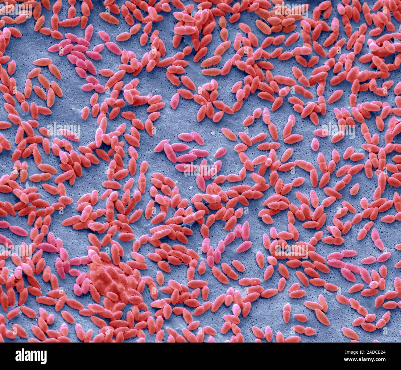 Bacterial culture from a trainer. Scanning electron micrograph (SEM) of ...