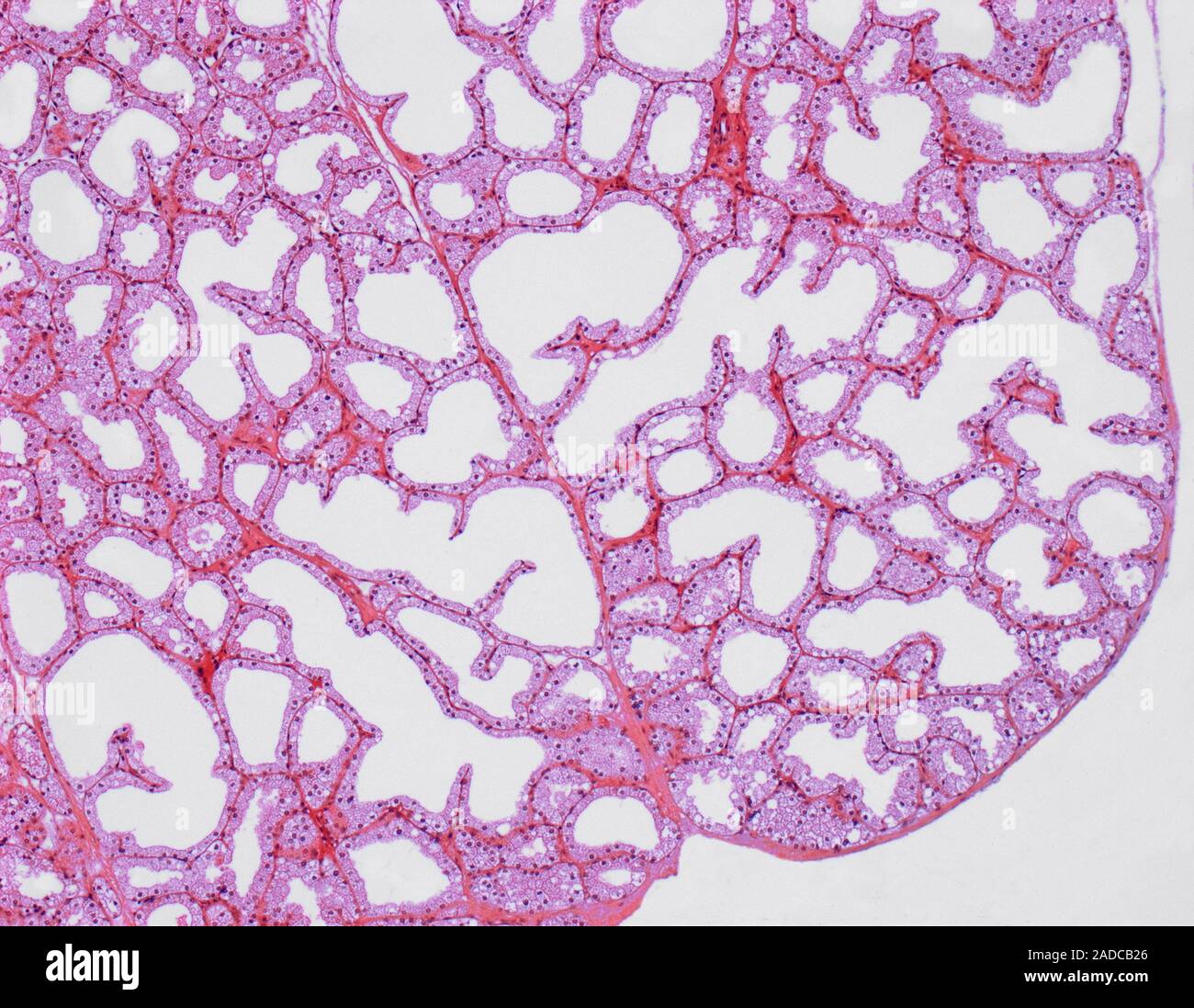 Lachrymal gland. Light micrograph of a section through the lachrymal ...