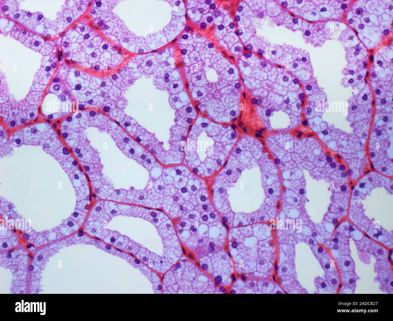 Lachrymal gland. Light micrograph of a section through the lachrymal ...