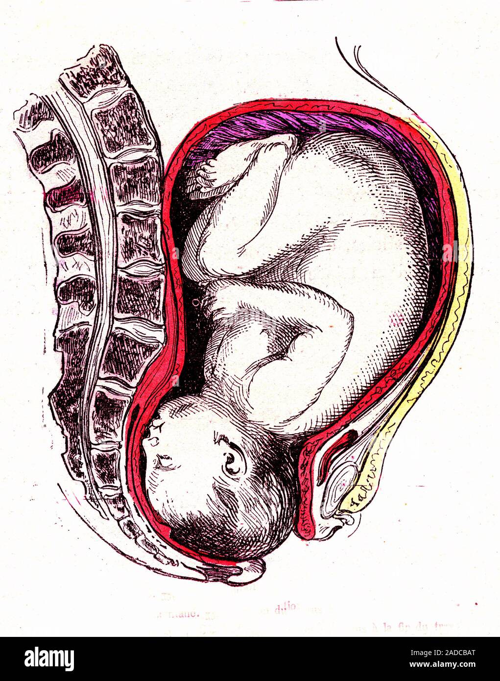 Child in birth position. 1881 anatomical illustration of a fully ...