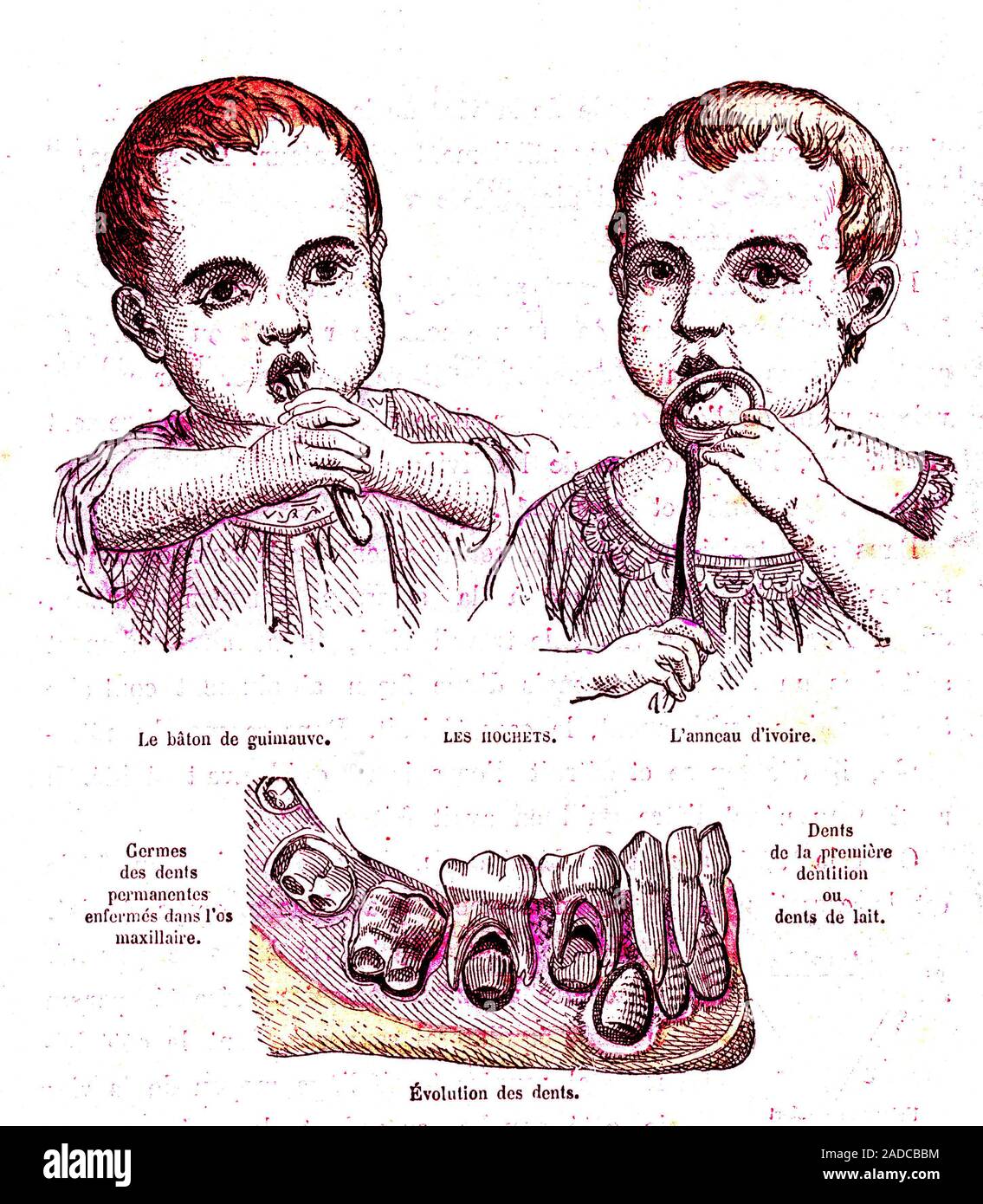 Teething child. 1881 illustration depicting the development of a child ...