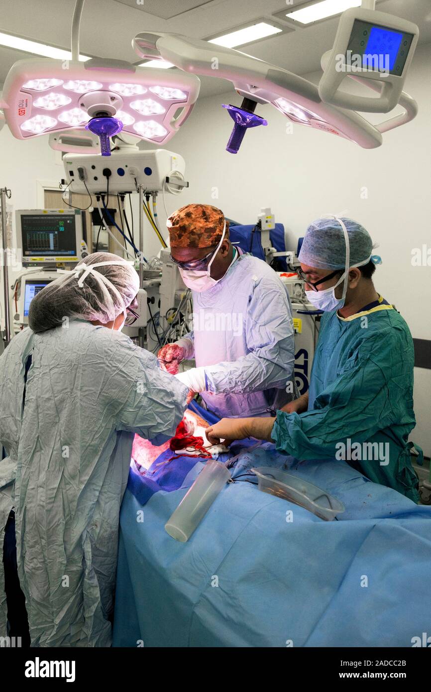 Intestinal surgery. Surgical team operating to remove part of a patient ...