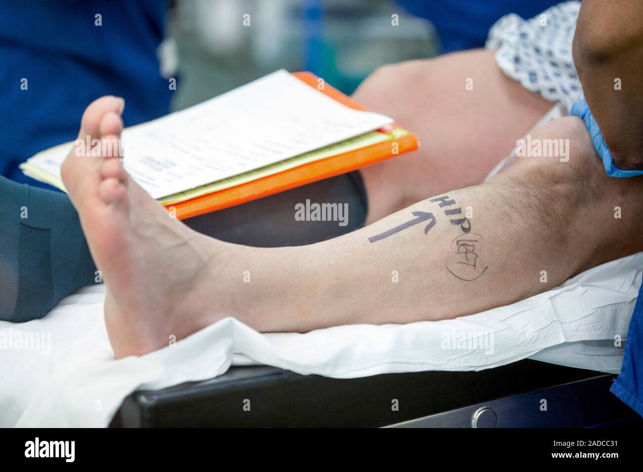 Hip replacement surgery preparations. Close-up of the leg of a patient ...