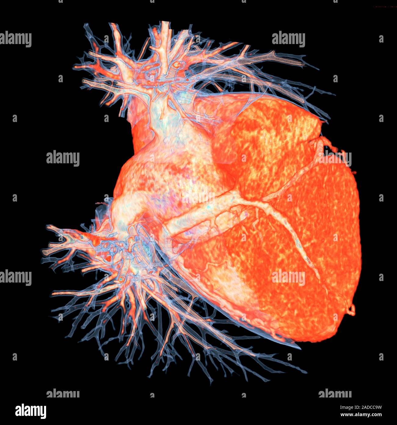 Human heart, 3D coloured computed tomography (CT) scan. The heart is a ...