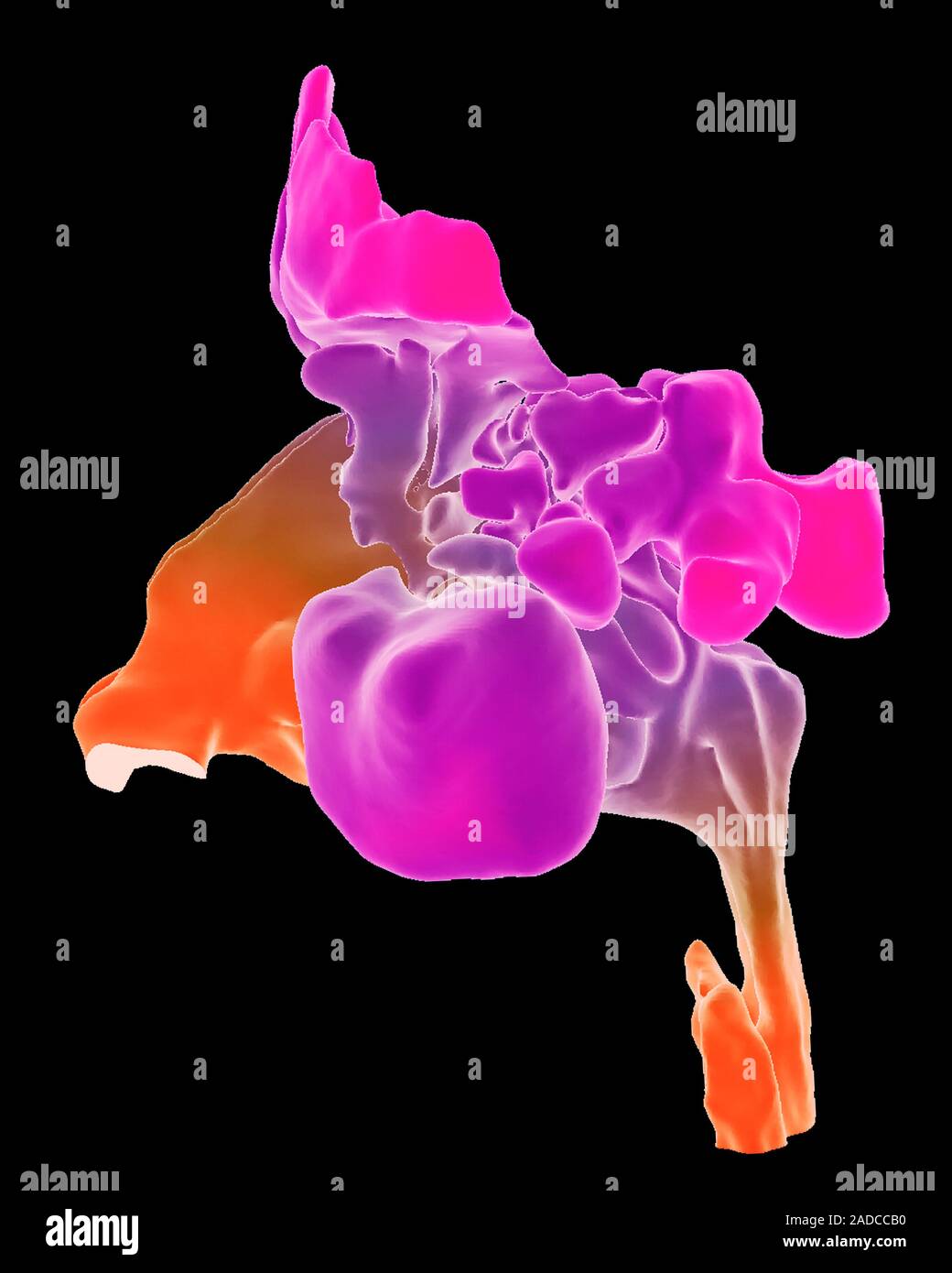 Throat and paranasal sinuses. Coloured 3D computed tomography (CT) scan ...