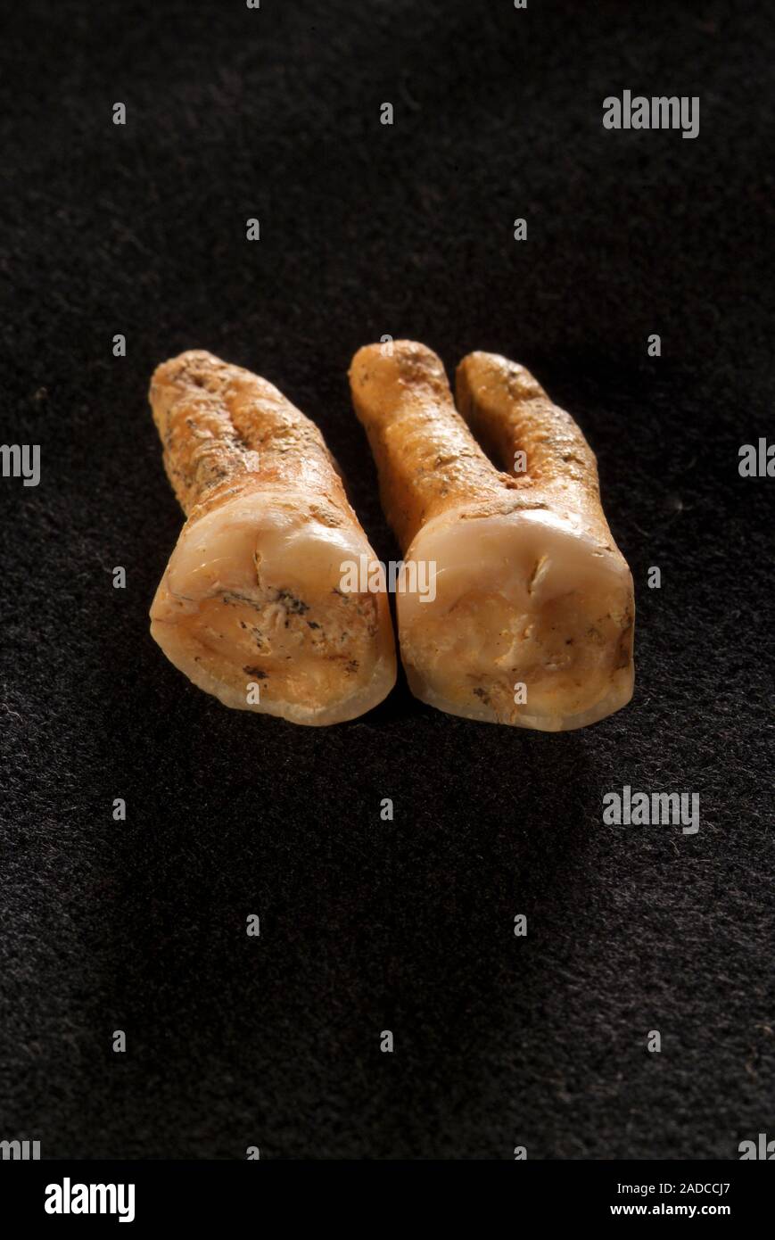 Neanderthal teeth. These teeth are the 3rd and 4th upper molars from a ...