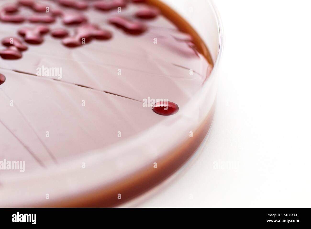 Serratia Marcescens Nutrient Agar