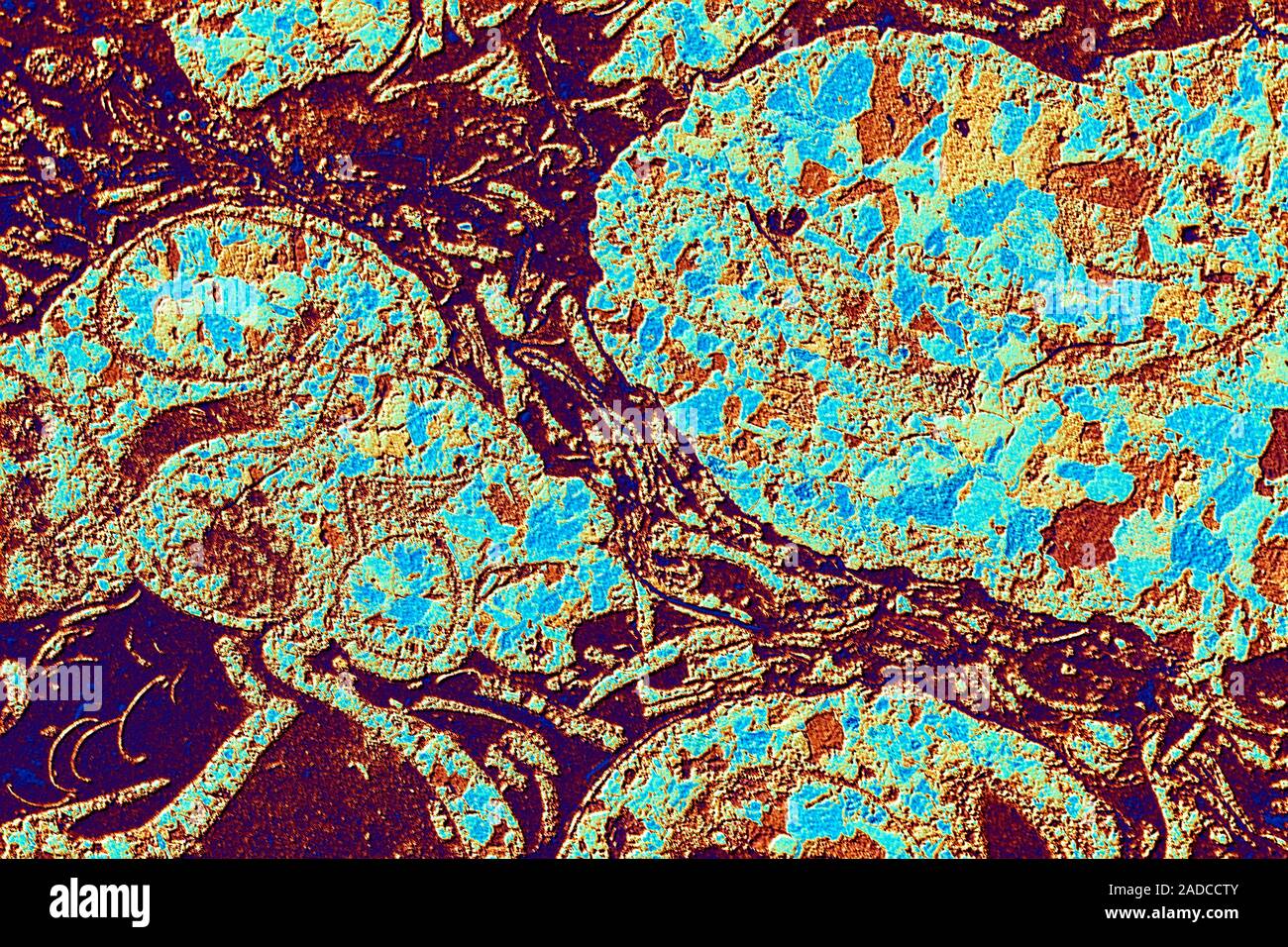 Shelly limestone. Computer enhanced polarised light micrograph of a ...
