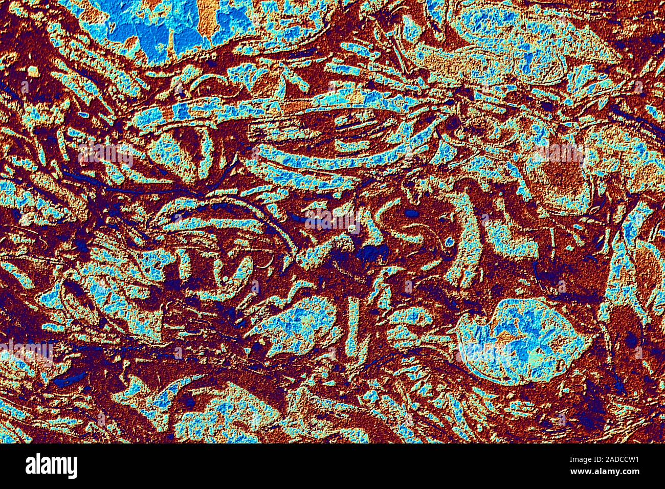 Shelly limestone. Computer enhanced polarised light micrograph of a thin section of a nummulitic ...