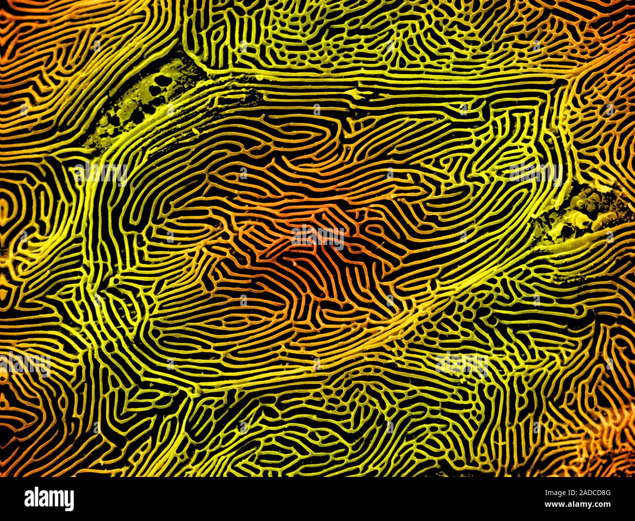 Fish scale, coloured scanning electron micrograph (SEM). These ...