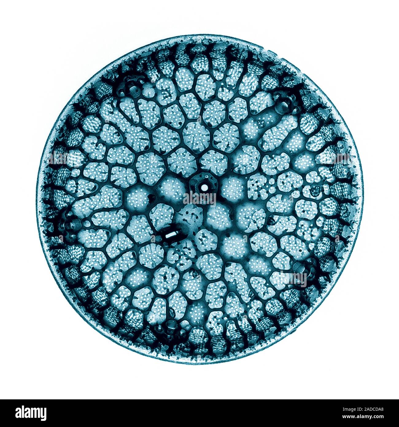 Centric diatom. Coloured transmission electron micrograph (TEM) of a ...