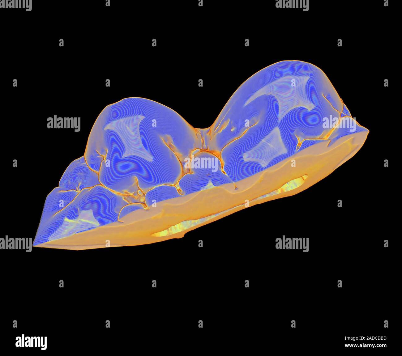 Pig tooth, 3D micro-computed tomography (CT) scan Stock Photo - Alamy