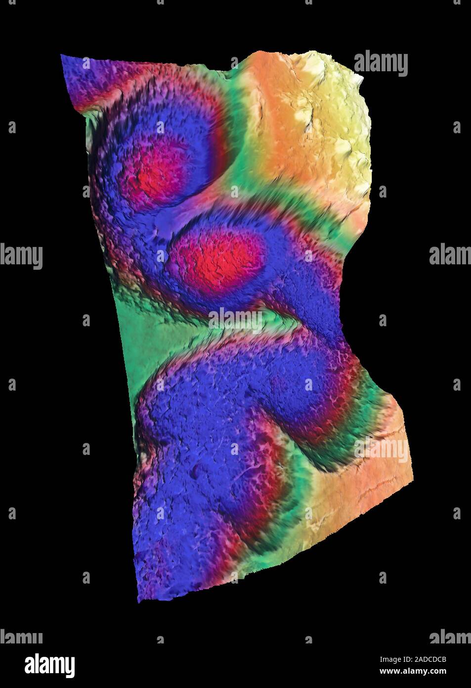 Osteoclast pits on dentine, coloured scanning electron micrograph (SEM ...