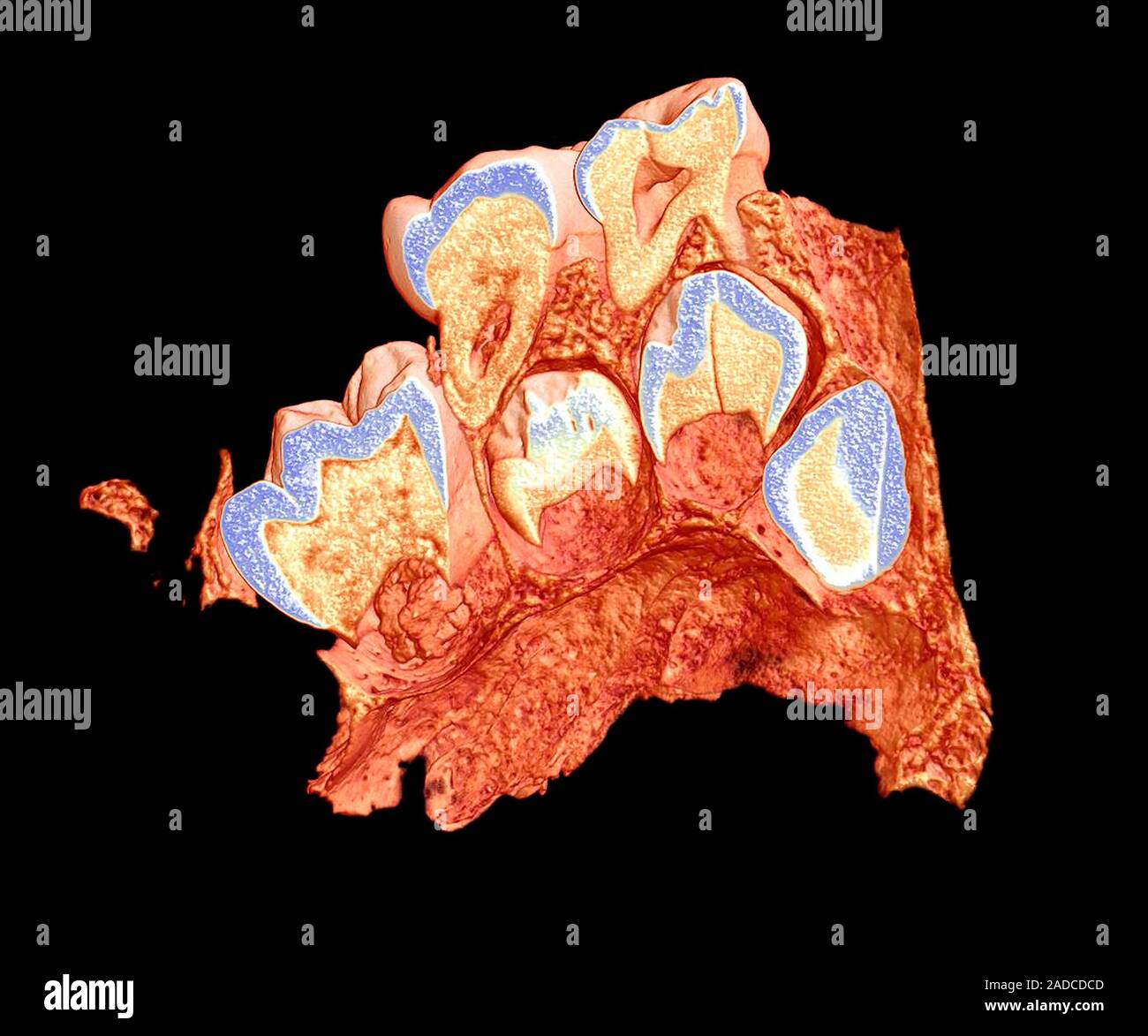 Upper jaw bone, 3D micro-computed tomography (CT) scan. This upper jaw ...