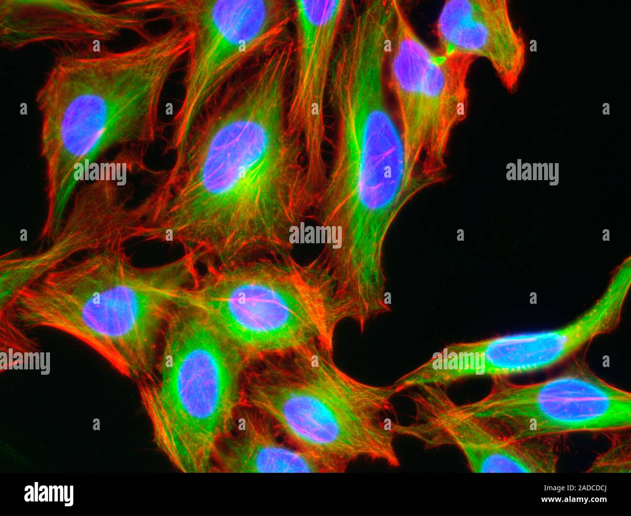 HeLa cervical cancer cells. Fluorescence light micrograph of HeLa ...