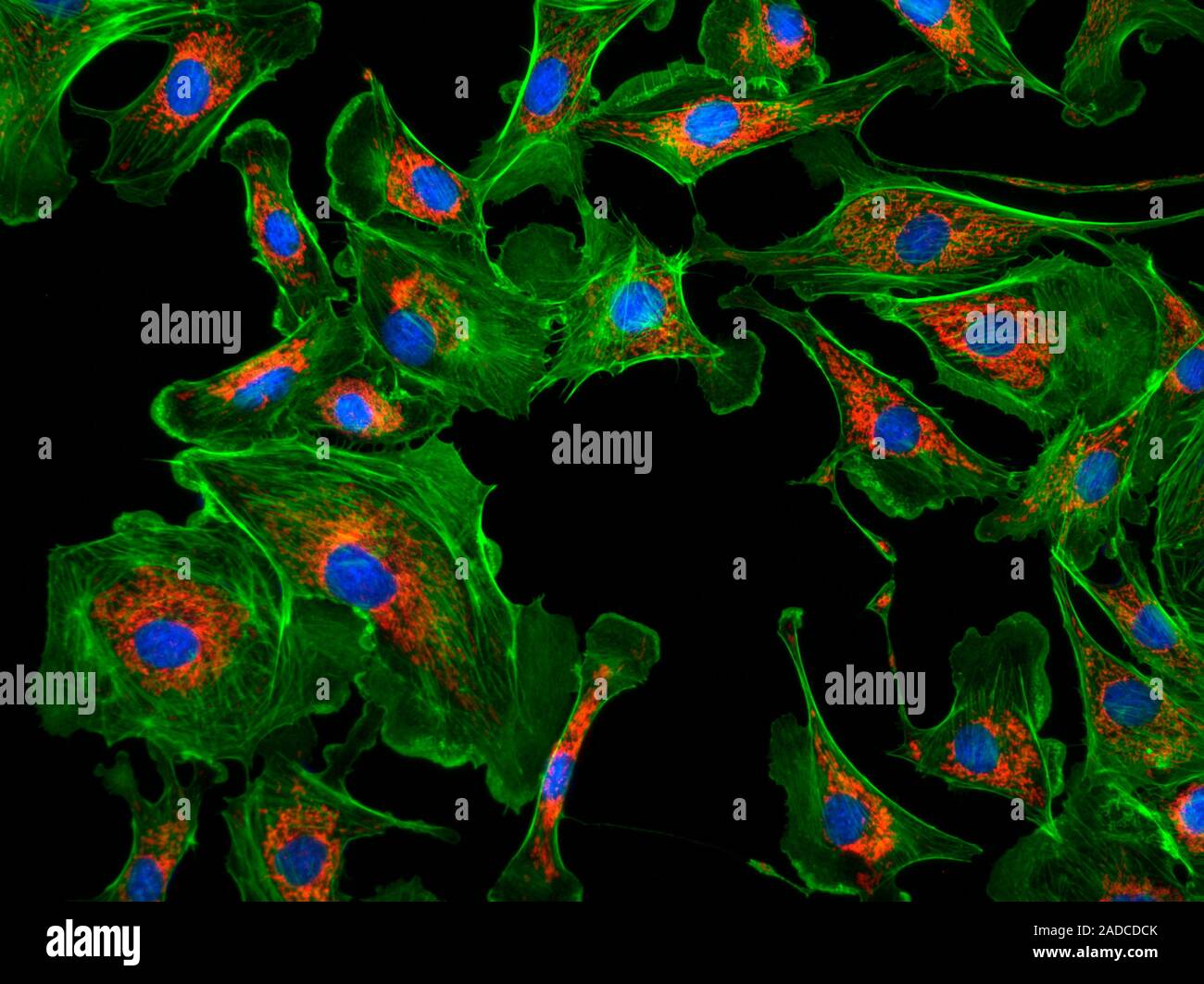 Cells stained for proteins. Fluorescence light micrograph of cells ...