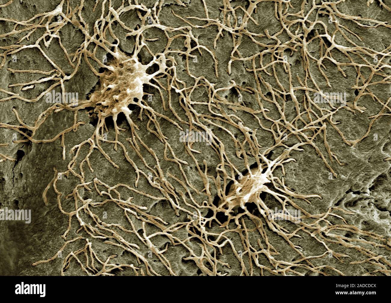 Osteocyte bone cells, coloured scanning electron micrograph (SEM ...