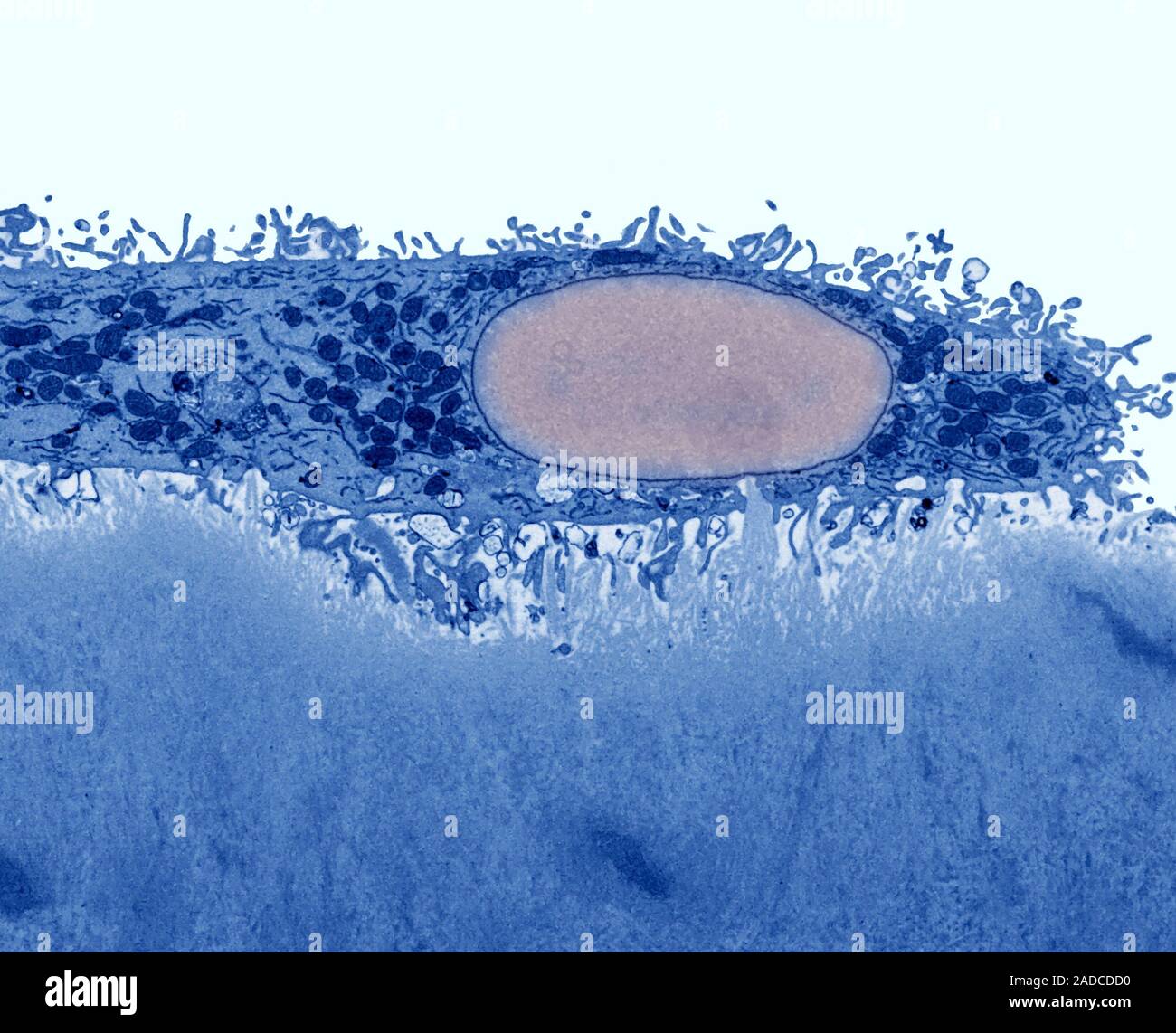 Osteoclast on dentine, coloured transmission electron micrograph (TEM ...