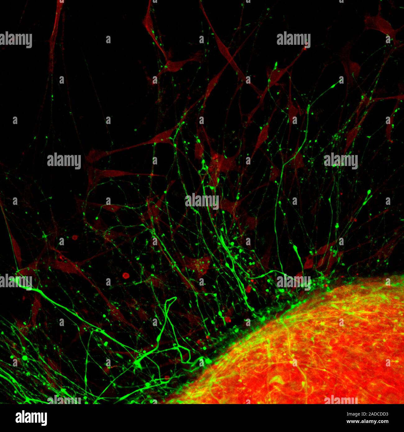 Nerve cell, fluorescence light micrograph. Proteins and other cellular ...