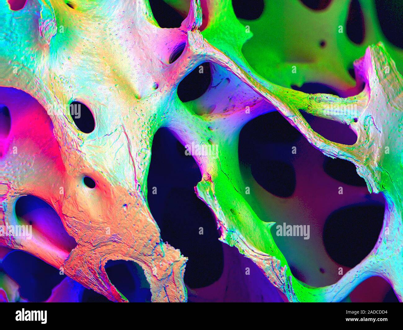 Skeletal bone core. Coloured scanning electron micrograph (SEM) of a ...