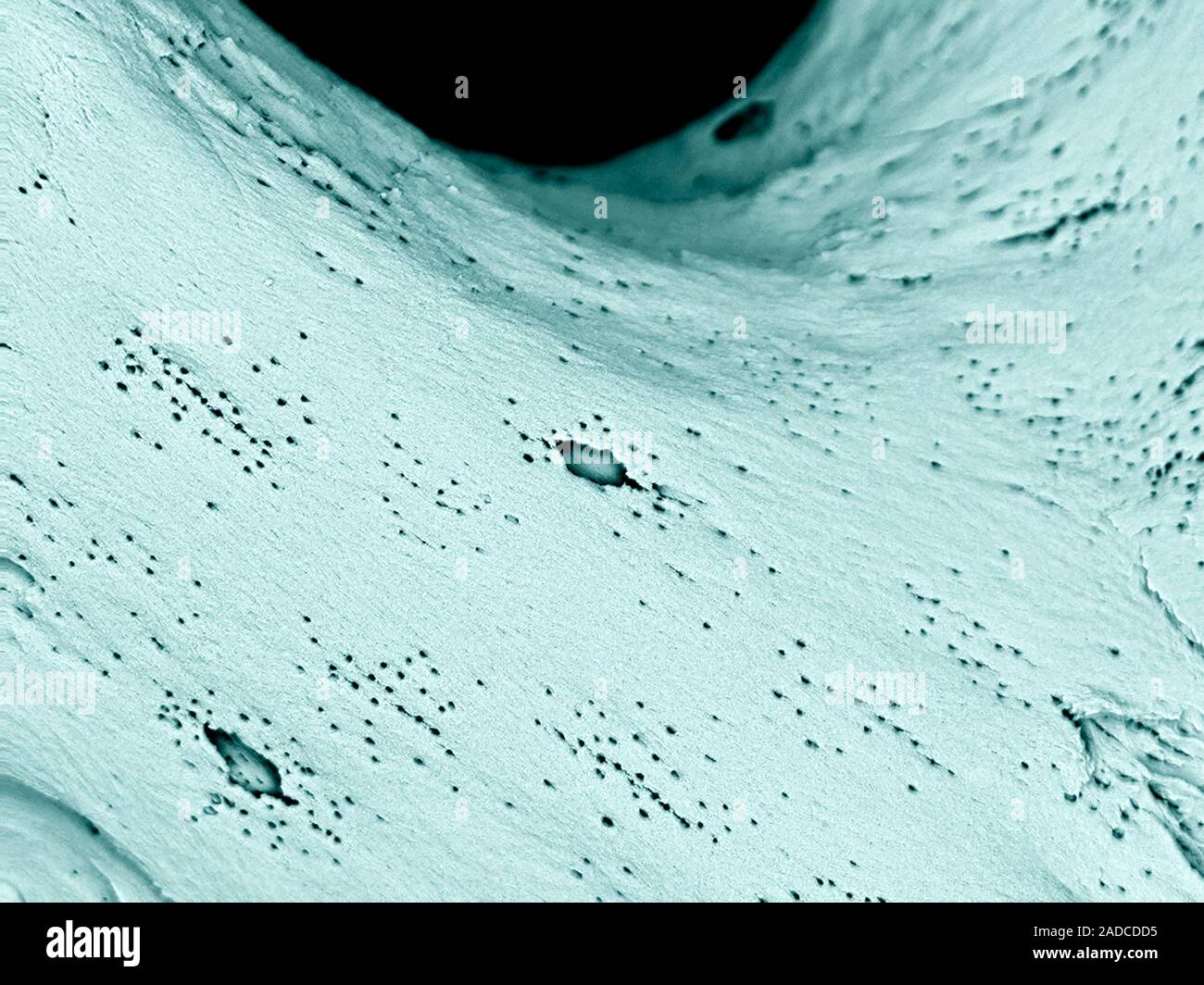 Skeletal bone core surface. Coloured scanning electron micrograph (SEM ...