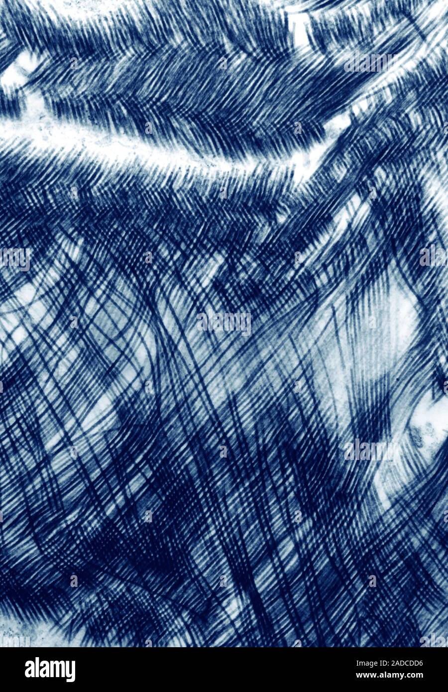 Crab shell fibres, coloured transmission electron micrograph (TEM) of a ...