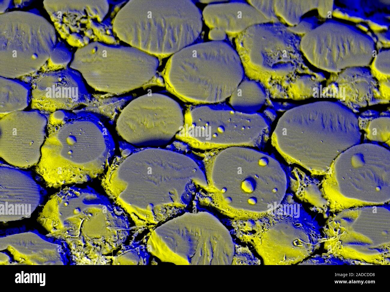 Fat cells. Coloured freeze-fractured scanning electron micrograph (SEM ...