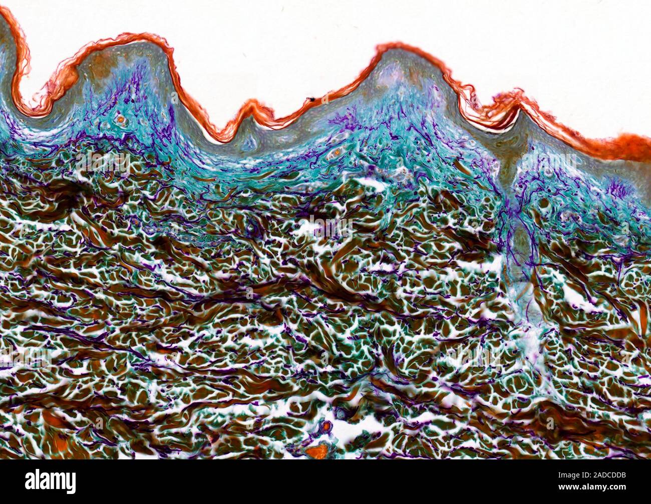Skin layers, light micrograph. Longitudinal section through layers of ...