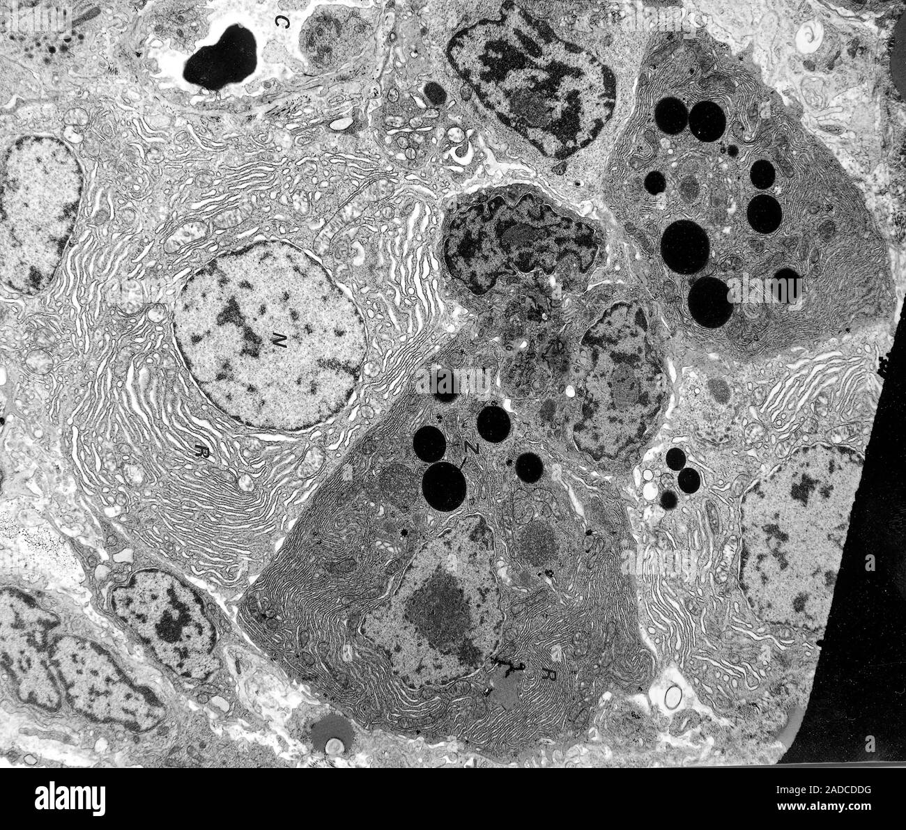 Pancreas tissue, transmission electron micrograph (TEM). The pancreas ...