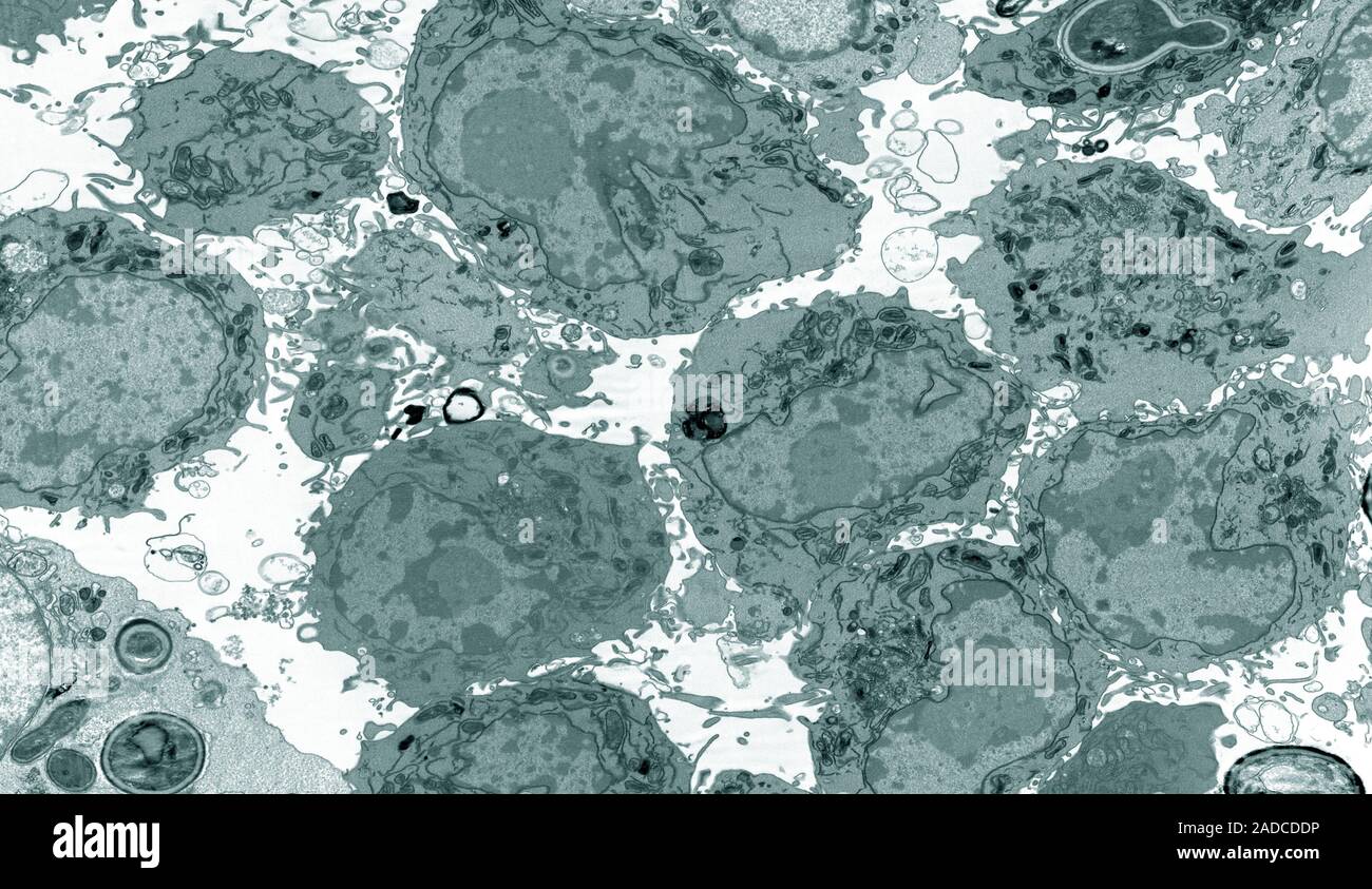 Macrophages infected with Candida yeast spores, transmission electron ...