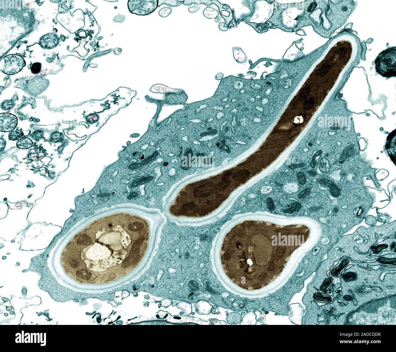 Macrophage infected with Candida yeast spores, coloured transmission ...