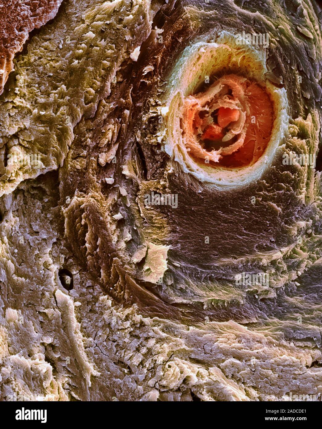 Coloured scanning electron micrograph of a mammalian leg bone fractured ...